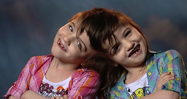 35.Hogan-twins | Qualia Computing